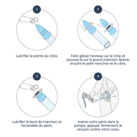 Medintim - Anneau de constriction à boucle pour Vacuum